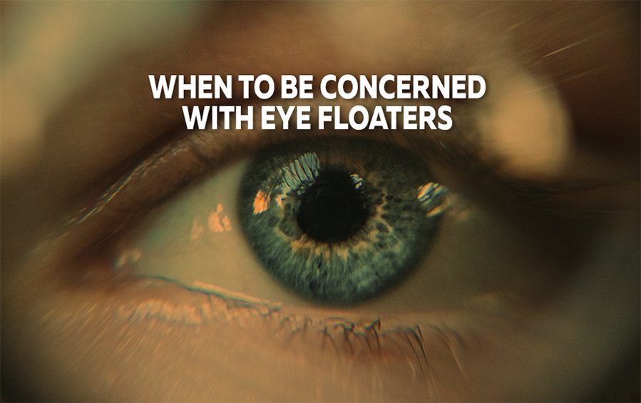 I See Wavy Lines In My Eyes Infoupdate I See Wavy Lines In My Eyes Infoupdate