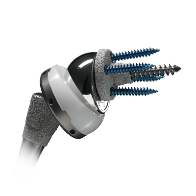 Zimmer Biomet Shoulder Replacement Recall | Faraci Lange Attorneys